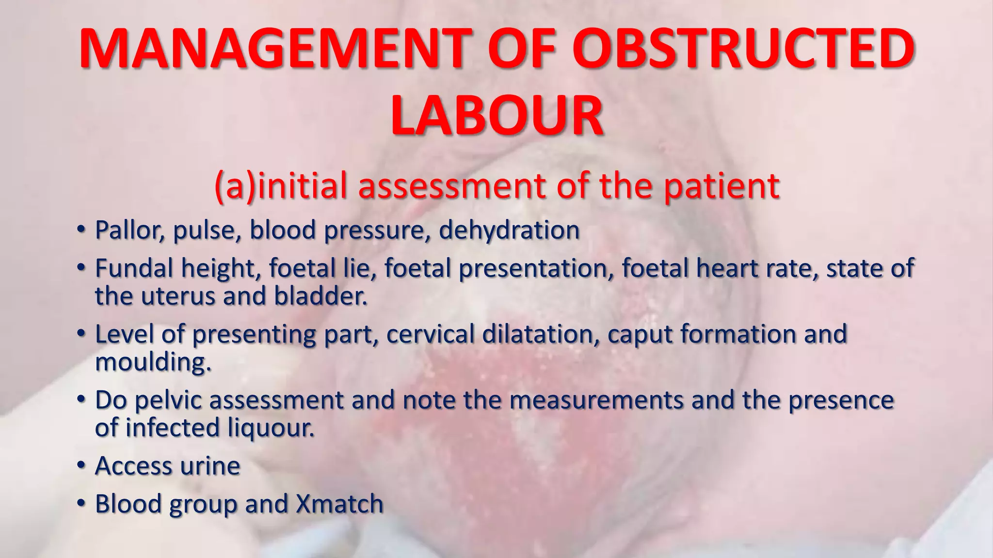 Prolonged labour | PPTX