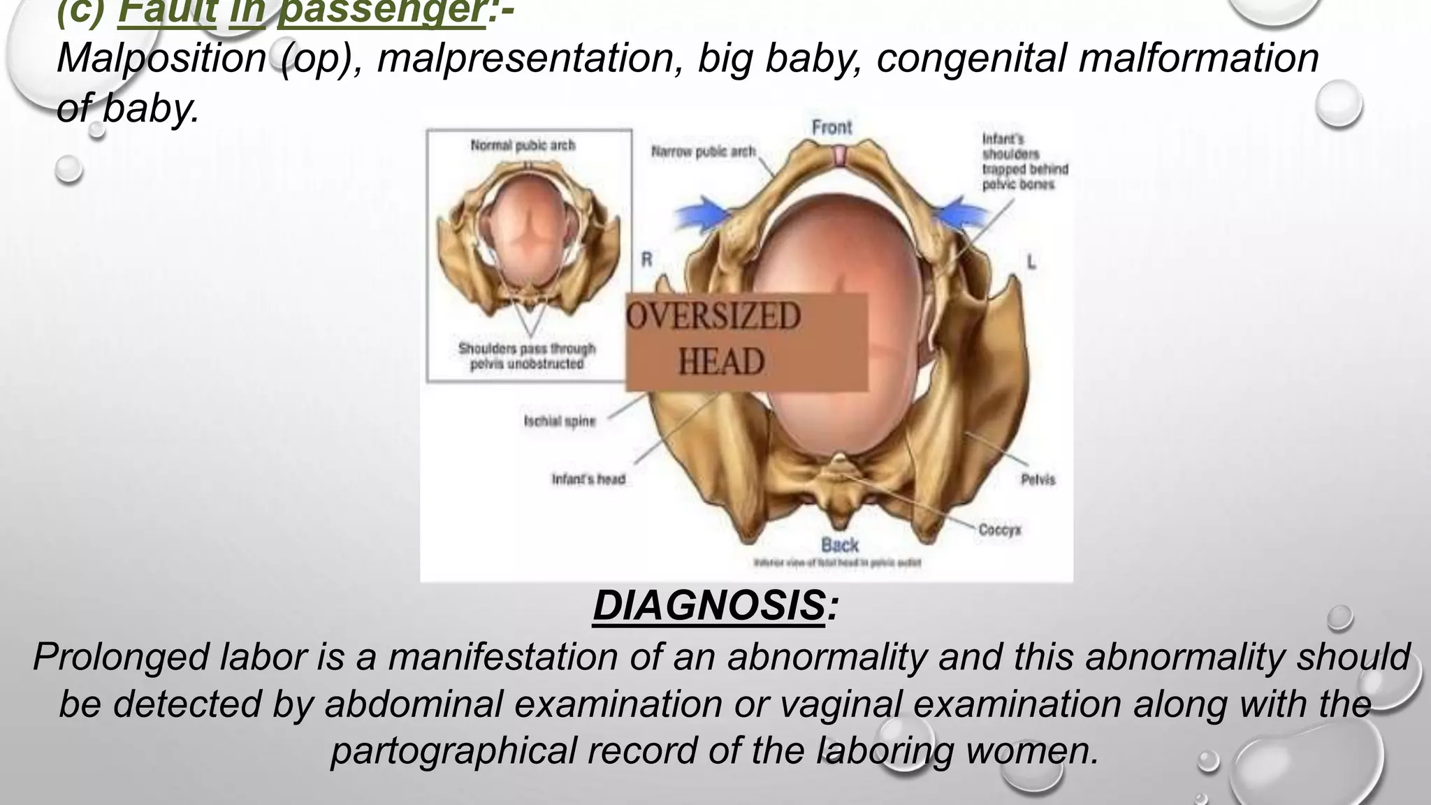Prolonged labour... | PPTX