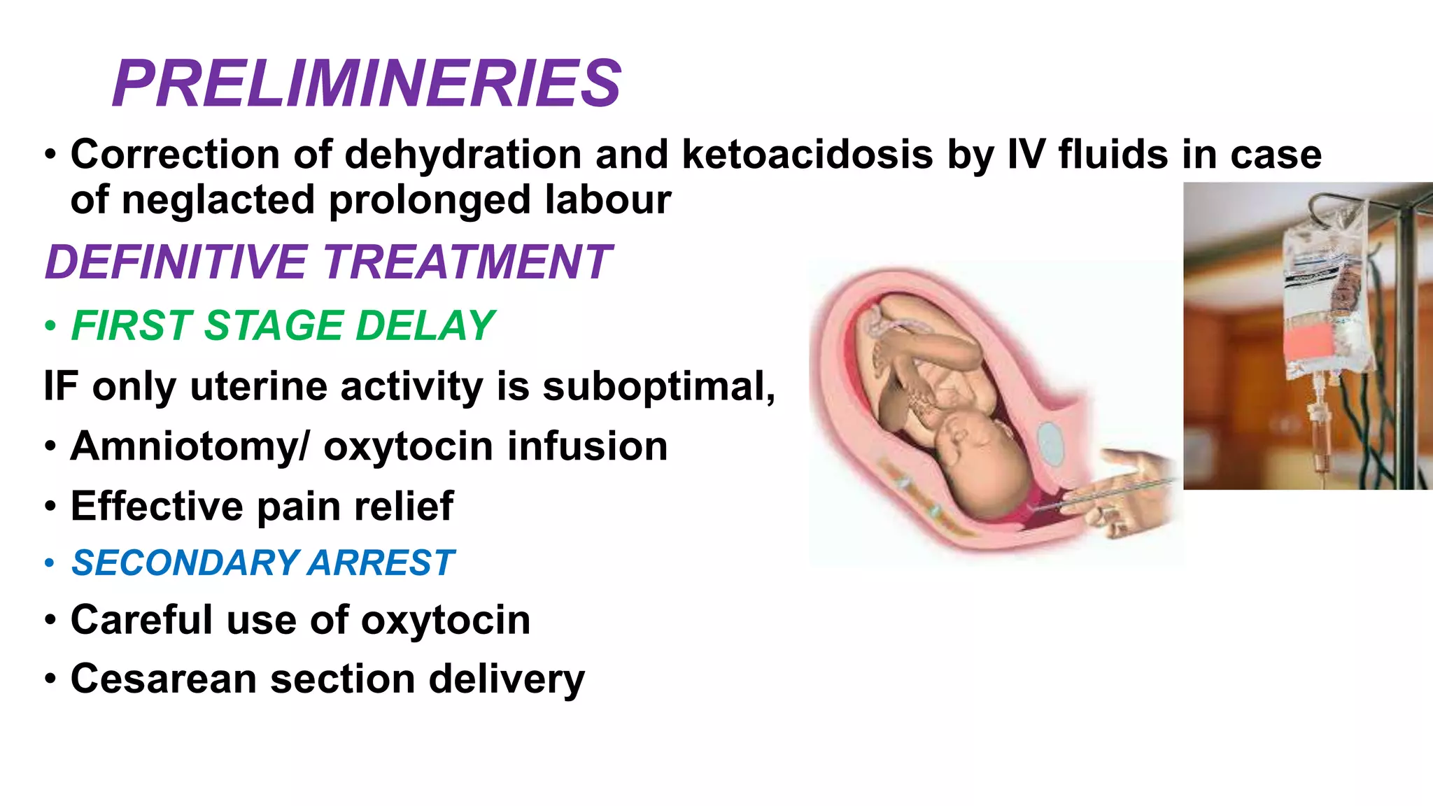 Prolonged labour | PPTX
