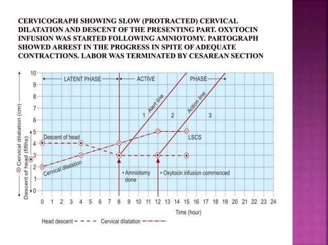 Prolonged labour | PPTX | Pregnancy | Reproductive Health
