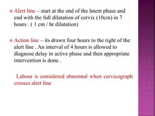 Prolonged labour | PPTX