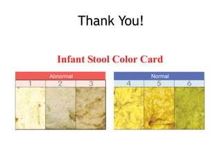 prolonged neonatal jaundiceee ( pNJ ).pdf