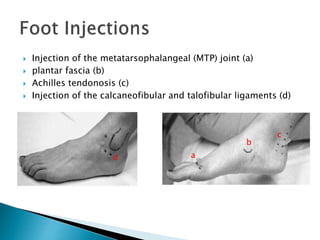 PROLOTHERAPY IN REHABILITATION & EVIDENCE.pptx | Death, Injury, or ...