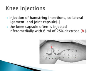 PROLOTHERAPY IN REHABILITATION & EVIDENCE.pptx | Death, Injury, or ...