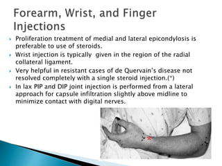 PROLOTHERAPY IN REHABILITATION & EVIDENCE.pptx | Death, Injury, or ...