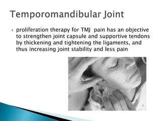 PROLOTHERAPY IN REHABILITATION & EVIDENCE.pptx | Death, Injury, or ...