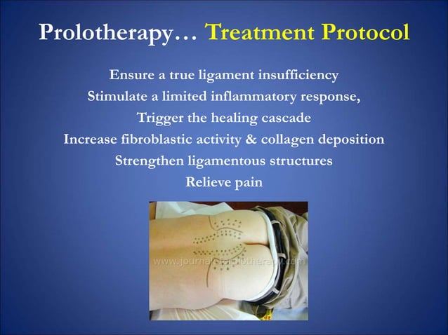 Spine Prolotherapy | PPT