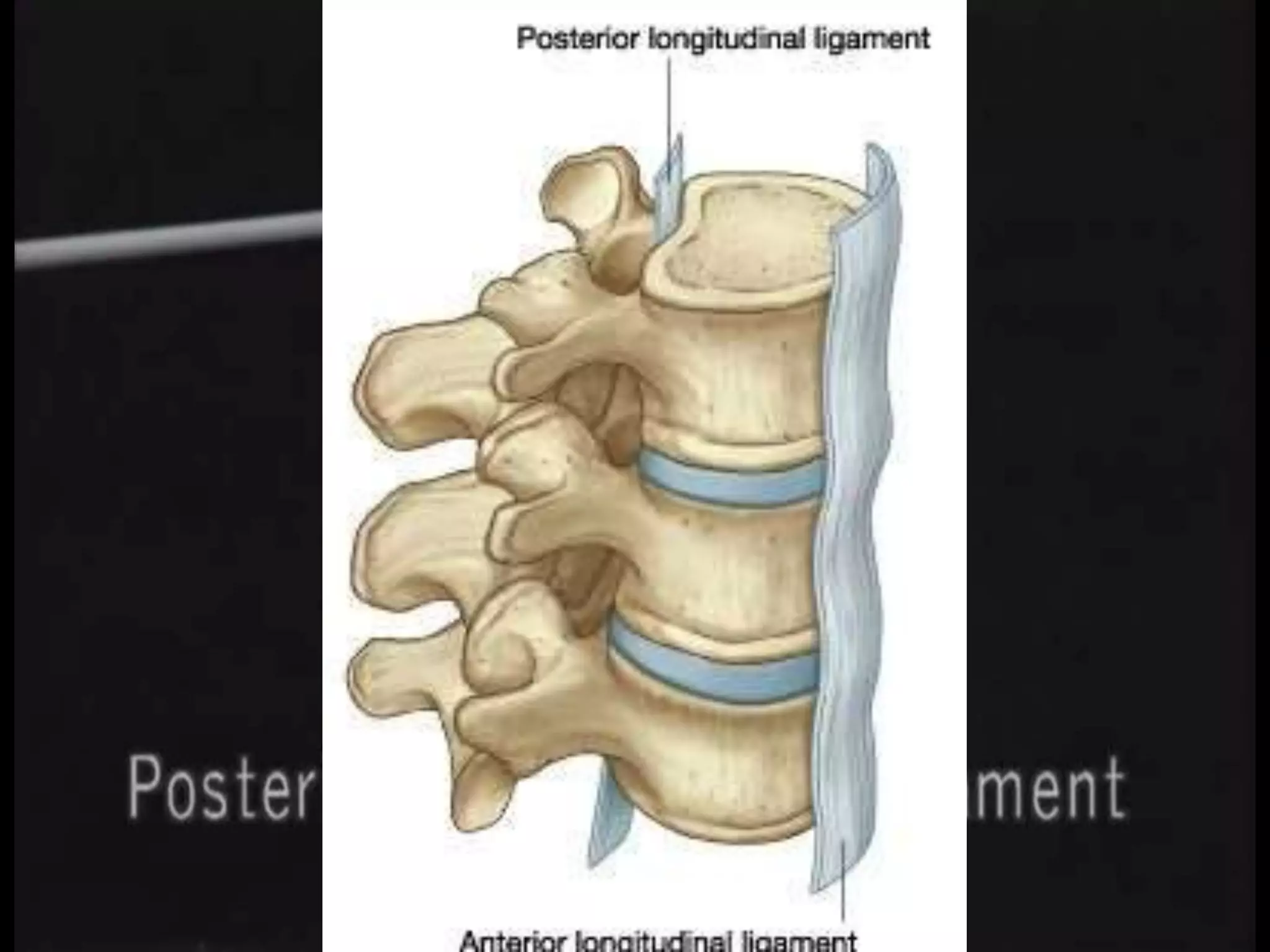 Prolpased inter vertebral disc (pivd) | PPTX