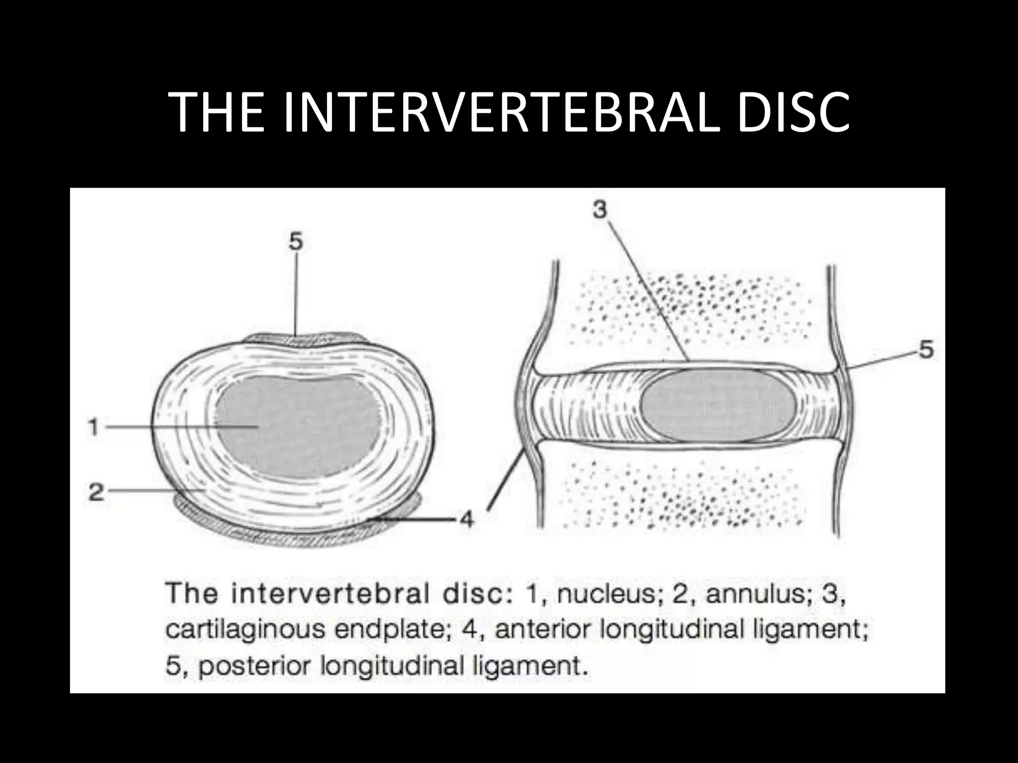 Prolpased inter vertebral disc (pivd) | PPTX