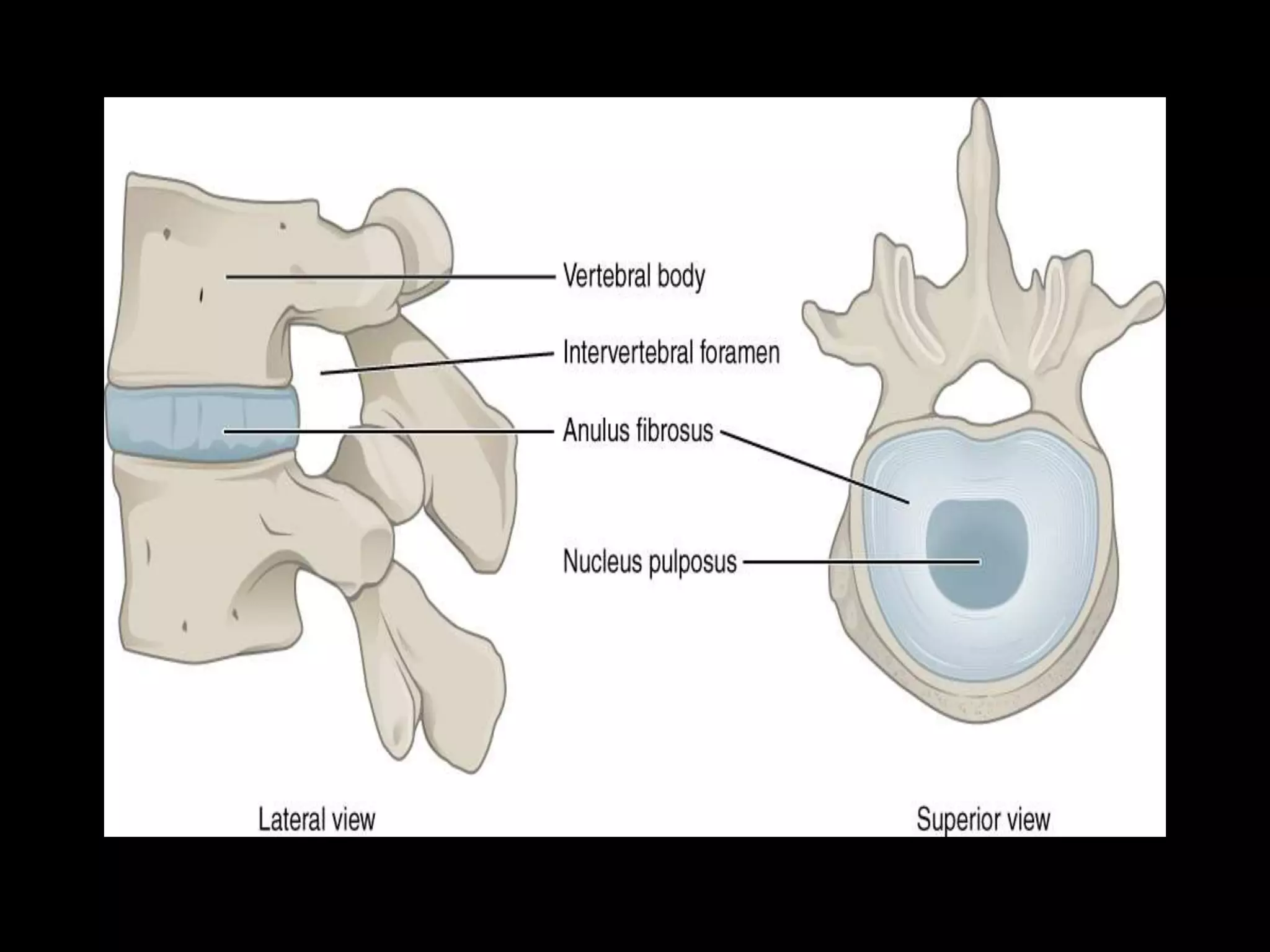 Prolpased inter vertebral disc (pivd) | PPTX