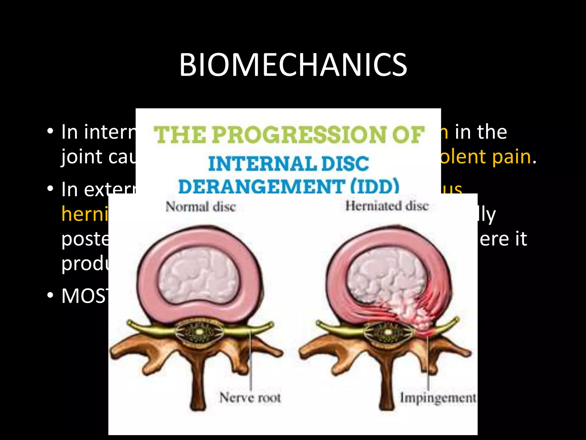 Prolpased inter vertebral disc (pivd) | PPTX