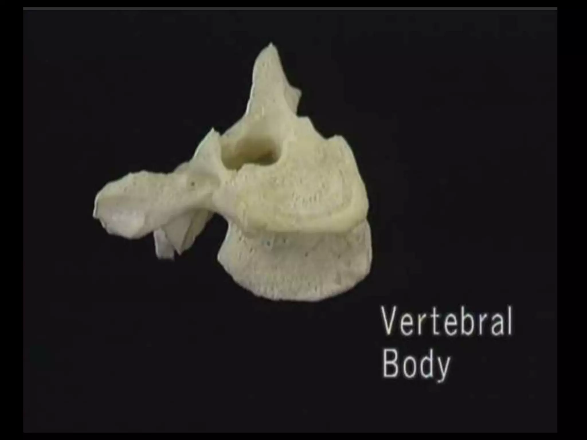 Prolpased inter vertebral disc (pivd) | PPTX