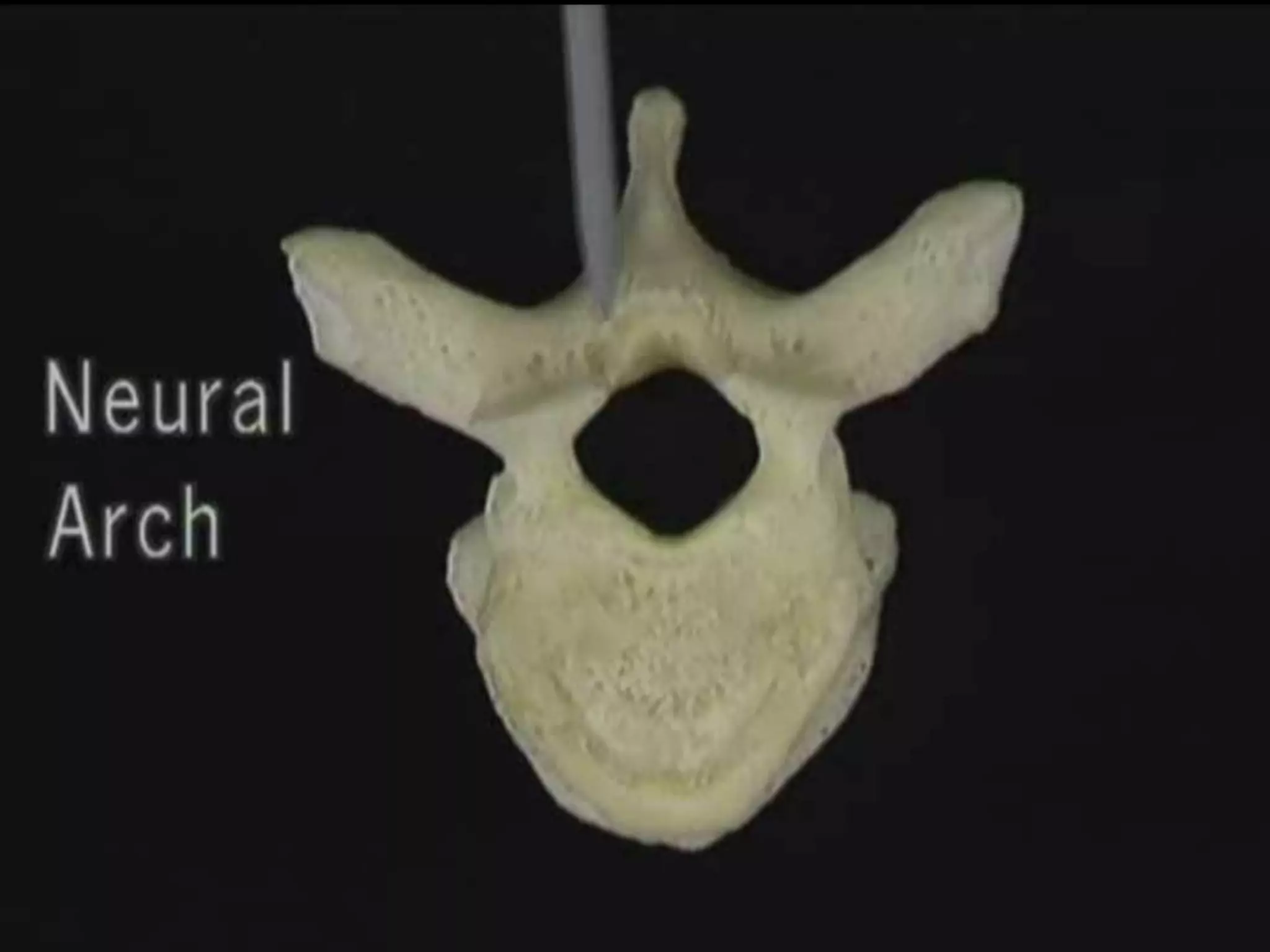 Prolpased inter vertebral disc (pivd) | PPTX