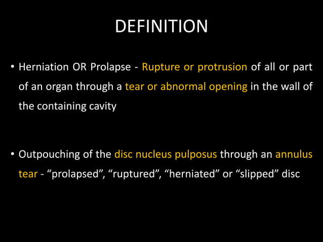 Prolpased inter vertebral disc (pivd) | PPTX | Death, Injury, or ...