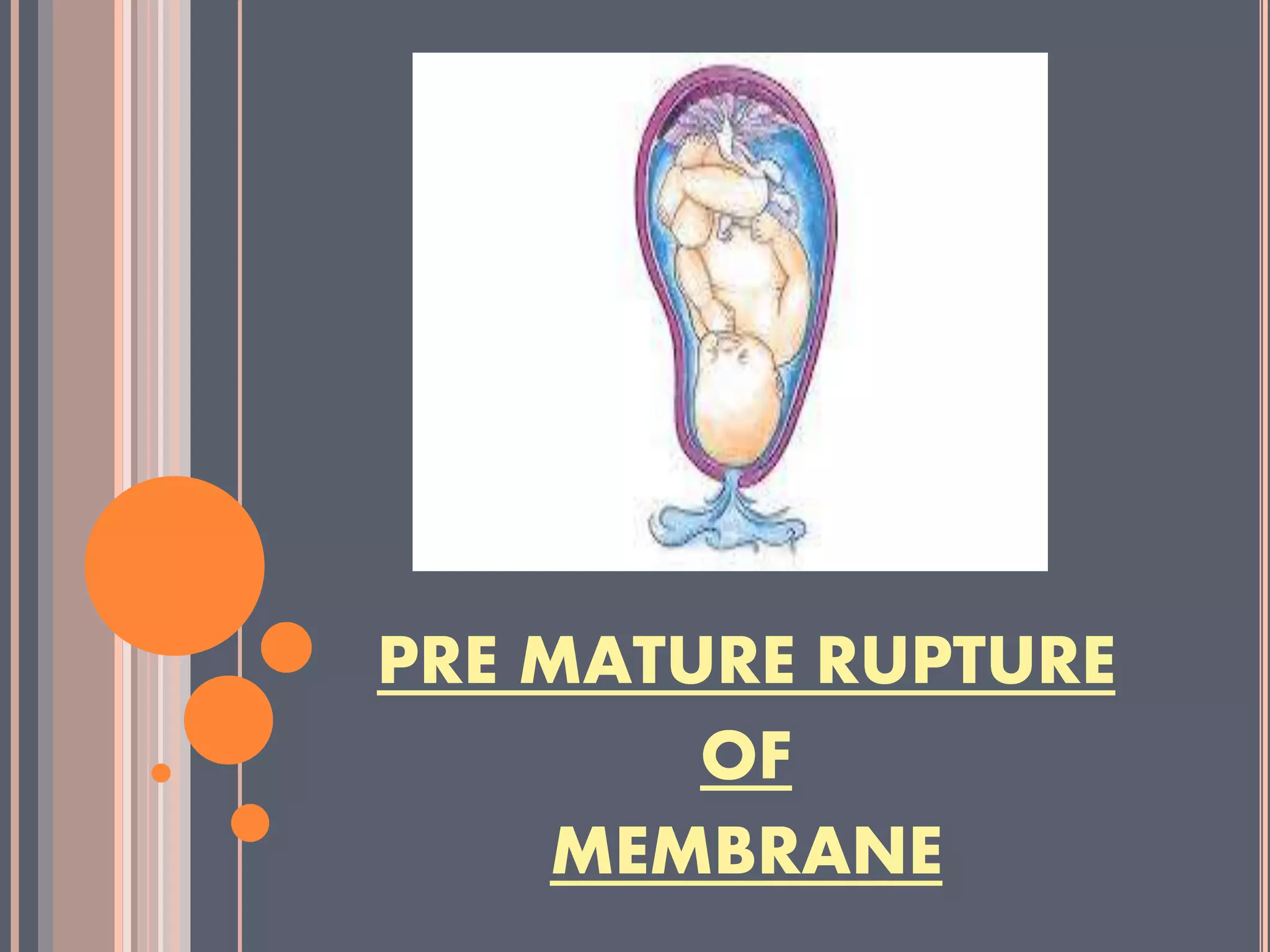 Pre mature rupture of membrene | PPTX