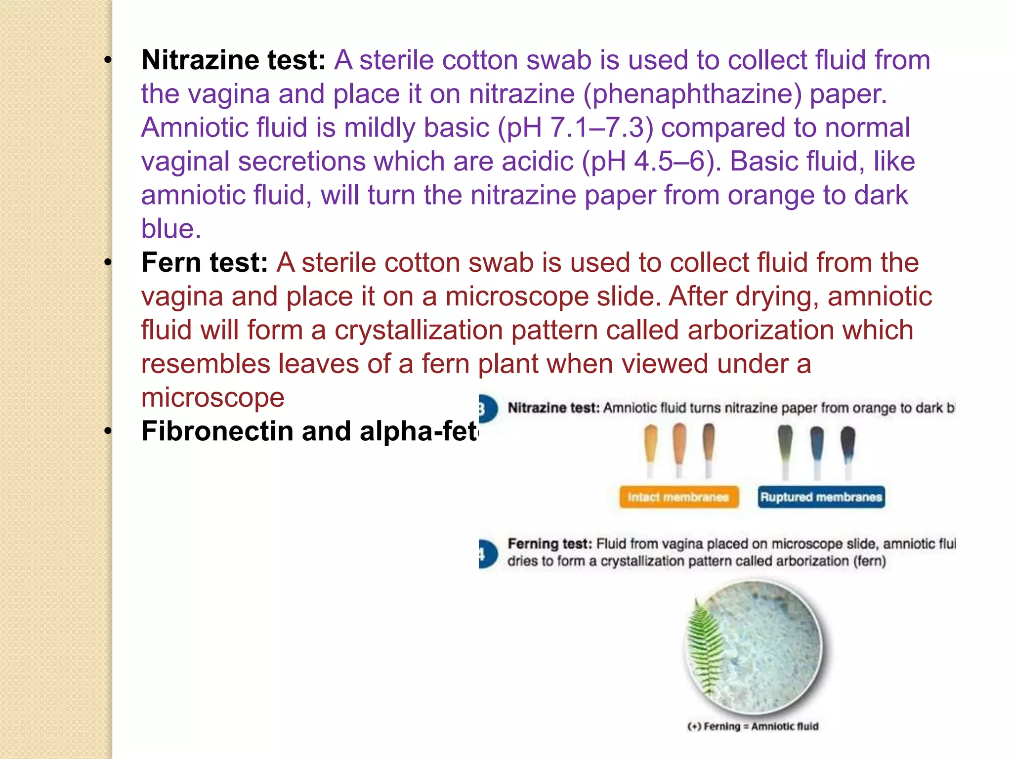 Pre-Labor Rupture of Membranes (PROM) | PPTX