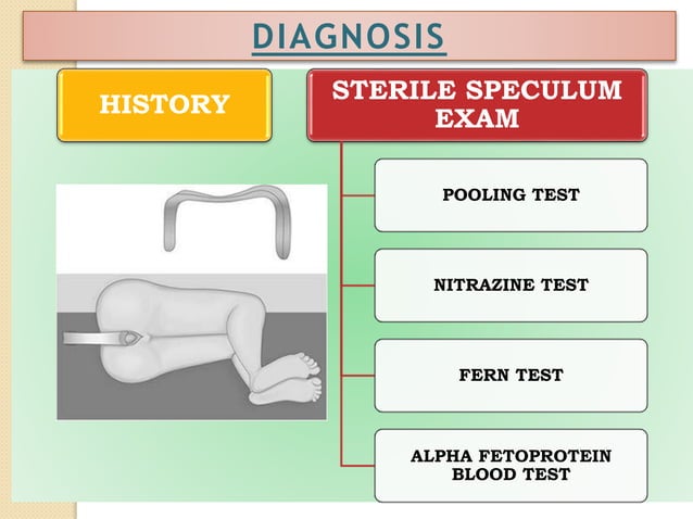 Pre-Labor Rupture of Membranes (PROM) | PPTX
