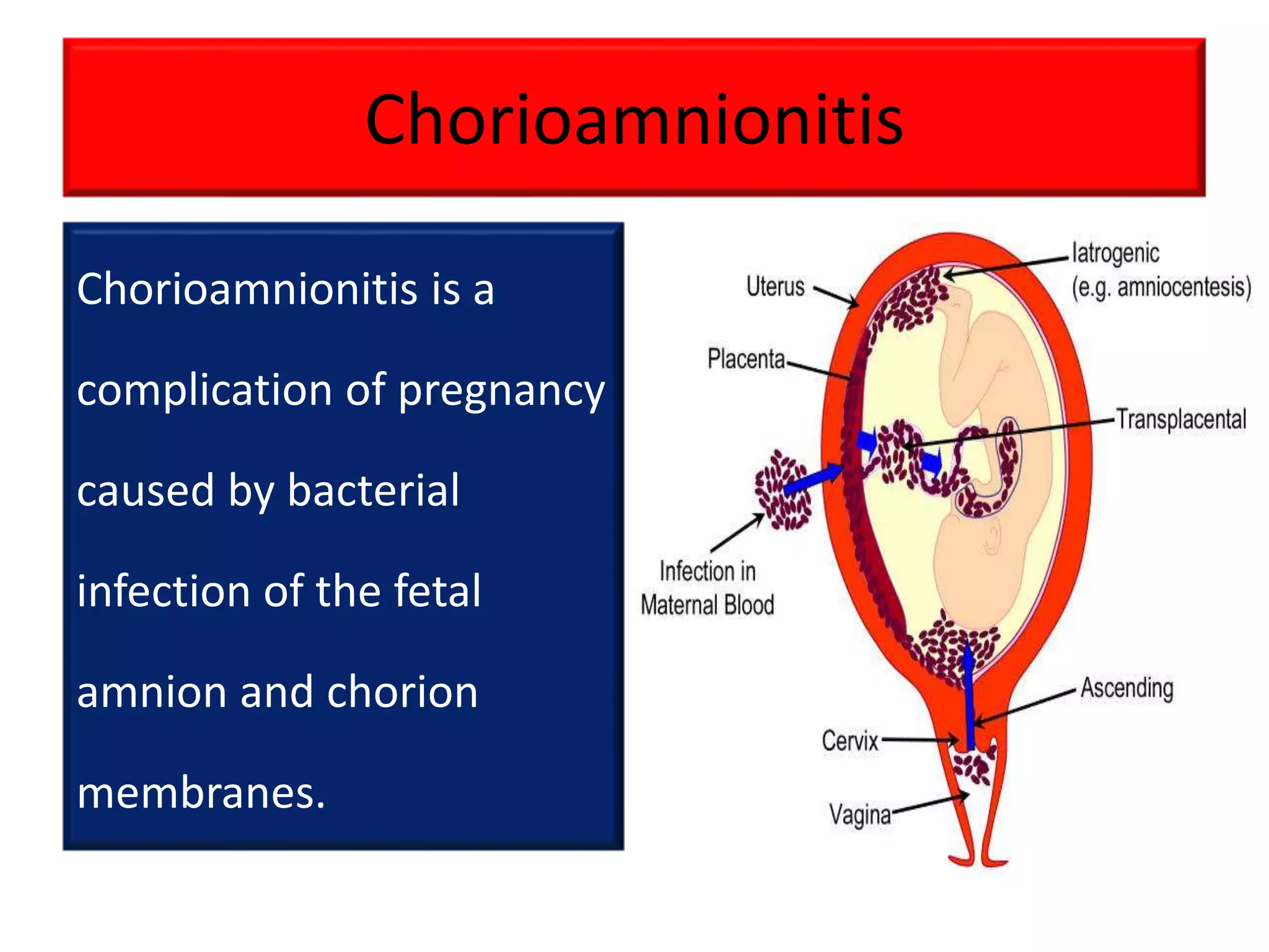 Prom and pprom | PPTX