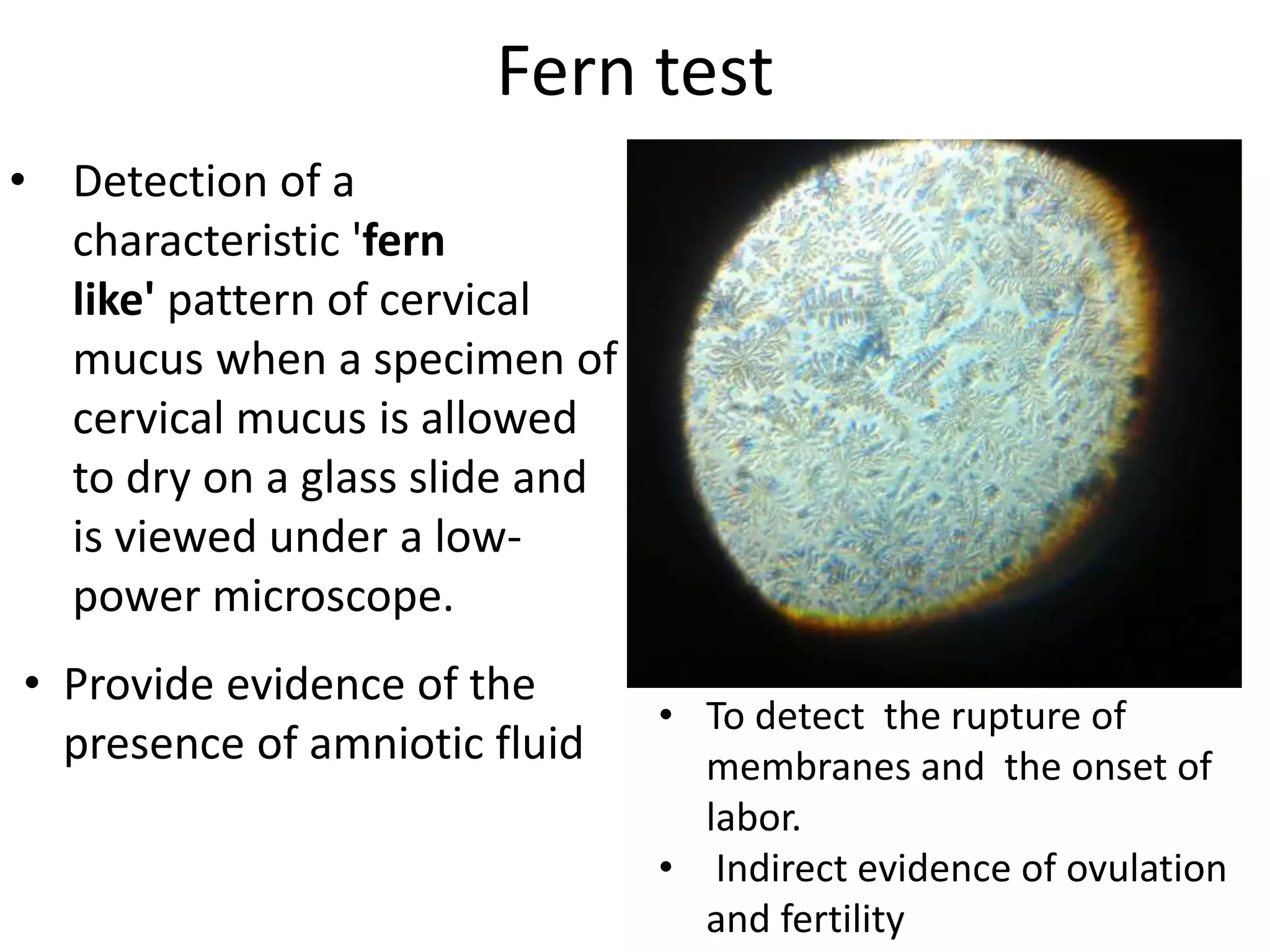 Prom and pprom | PPTX