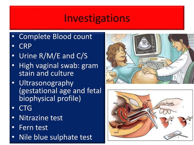 Prom and pprom | PPTX | Pregnancy | Reproductive Health