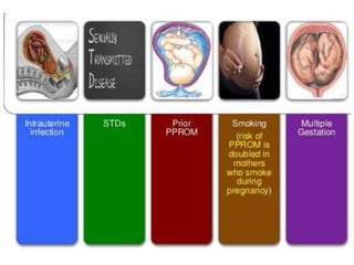 Prom and pprom | PPTX