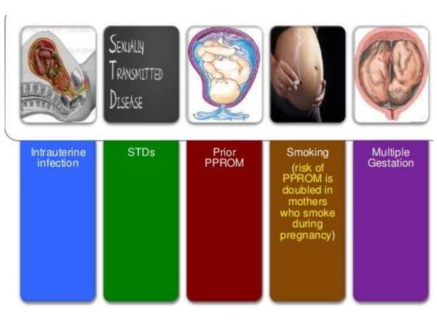 Prom and pprom | PPTX | Pregnancy | Reproductive Health