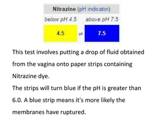PPT Point Of Care Testing: Vaginal PH PowerPoint, 55% OFF