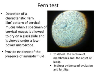 Prom and pprom | PPT