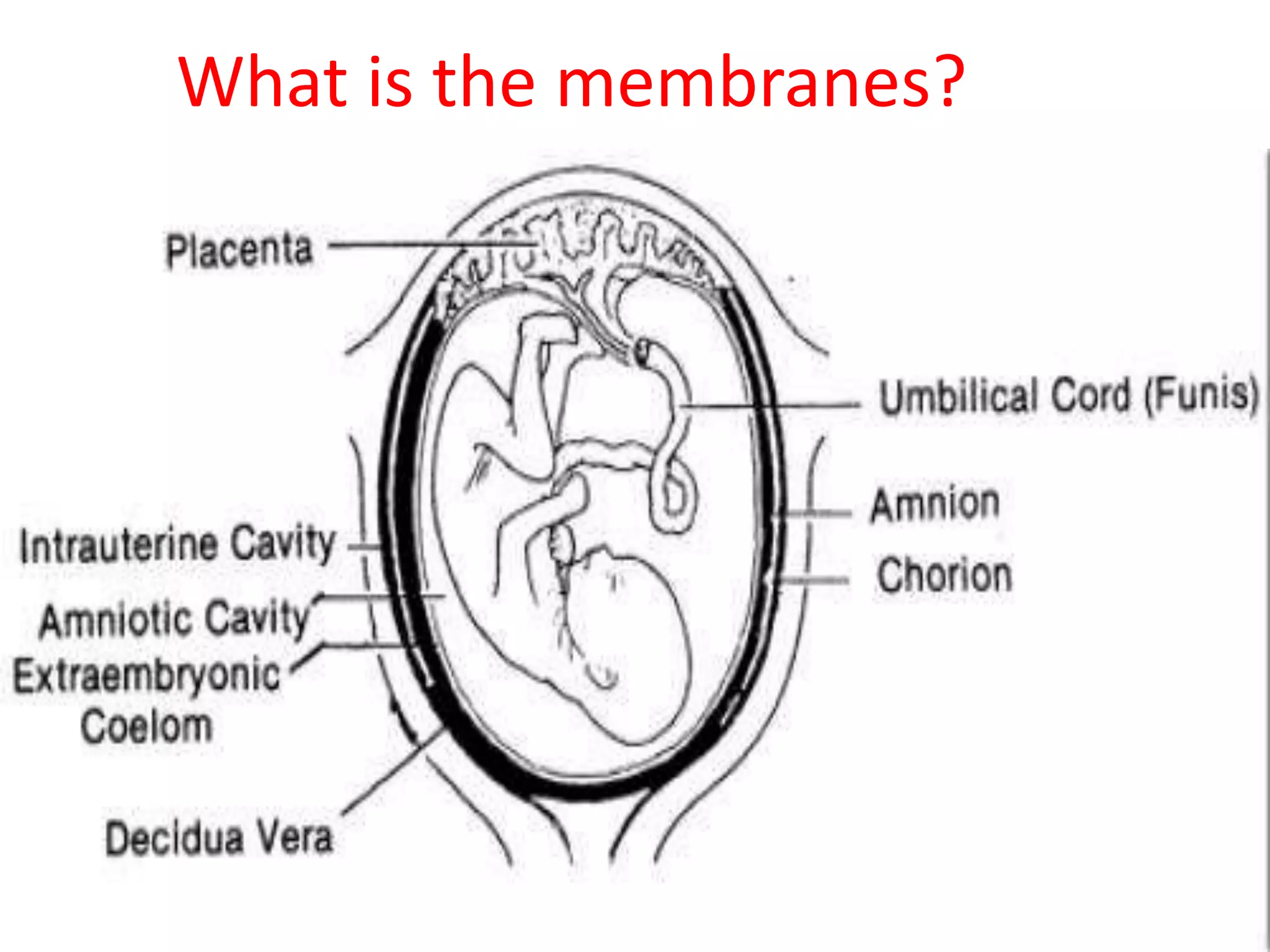 Premature rupture of membranes (PROM) | PPTX