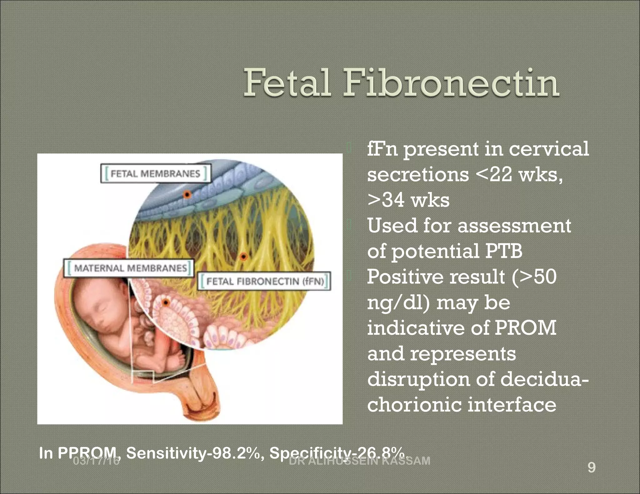 PROM AND PPROM BY Dr Alihussein kassam | PPT