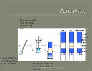 PROM AND PPROM BY Dr Alihussein kassam | PPT