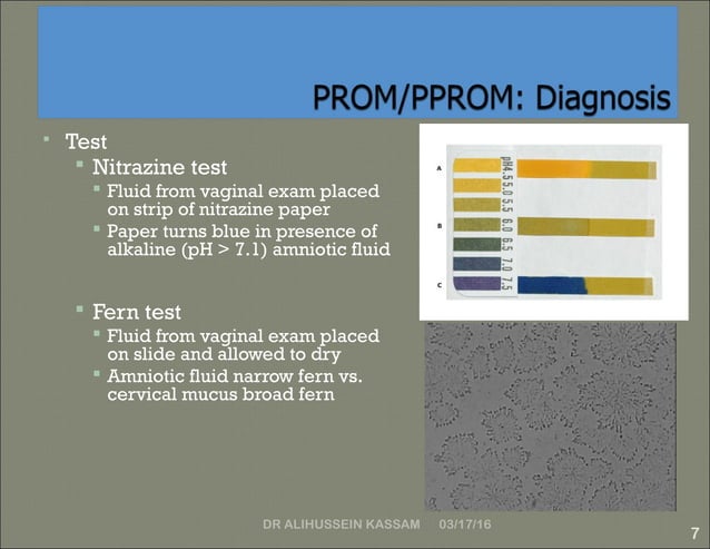 PROM AND PPROM BY Dr Alihussein kassam | PPT | Pregnancy | Reproductive ...
