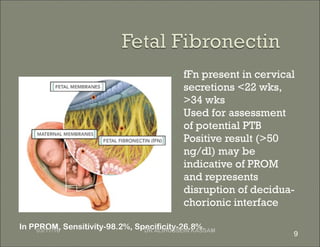 PROM AND PPROM BY Dr Alihussein kassam | PPT