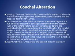 Prominent ears otoplasty | PPTX