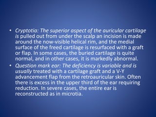 Prominent ears otoplasty | PPTX