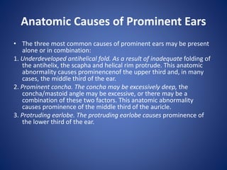 Prominent ears otoplasty | PPTX