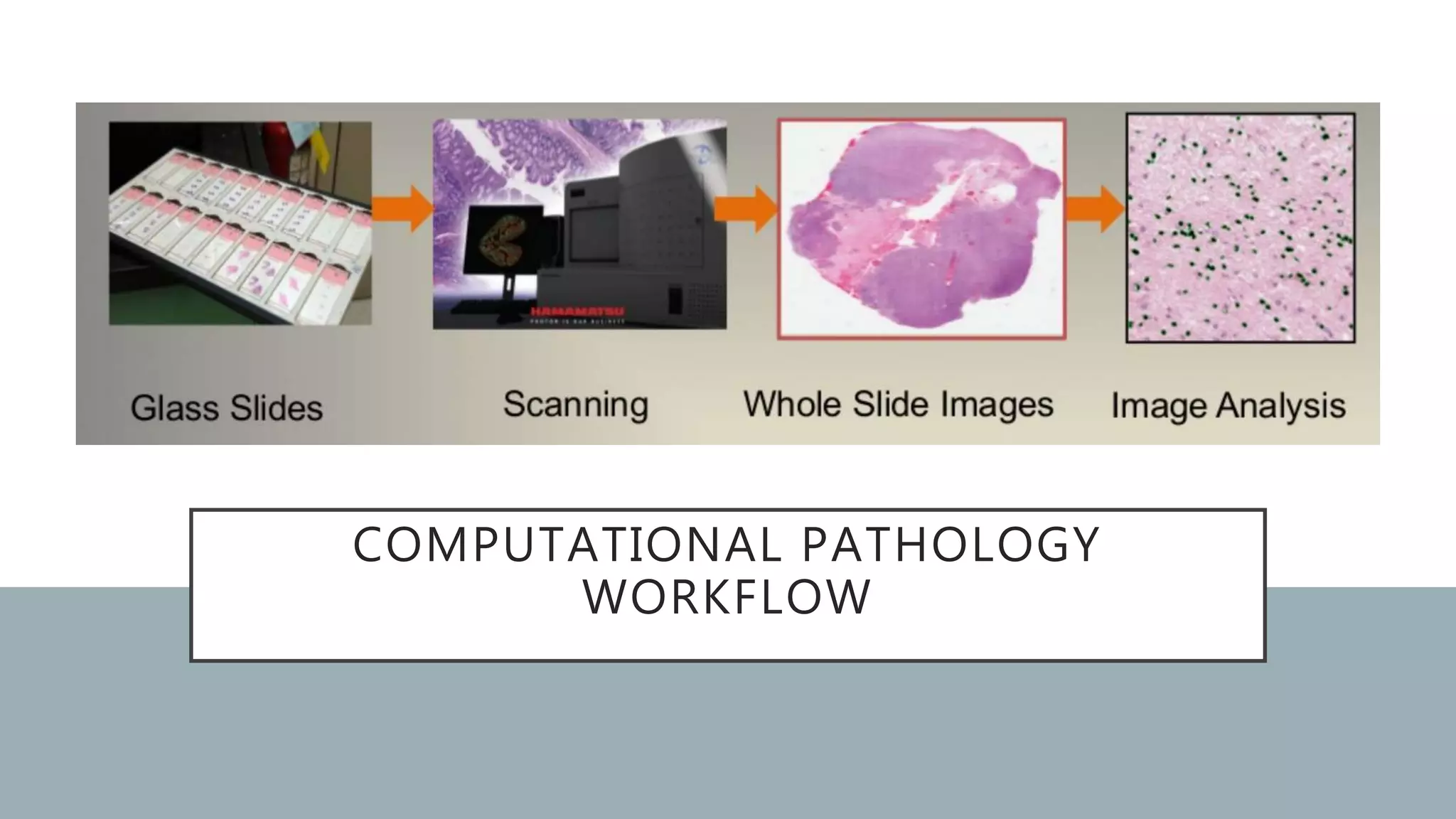 Promise of ai in improving cancer diagnosis and management | PPTX