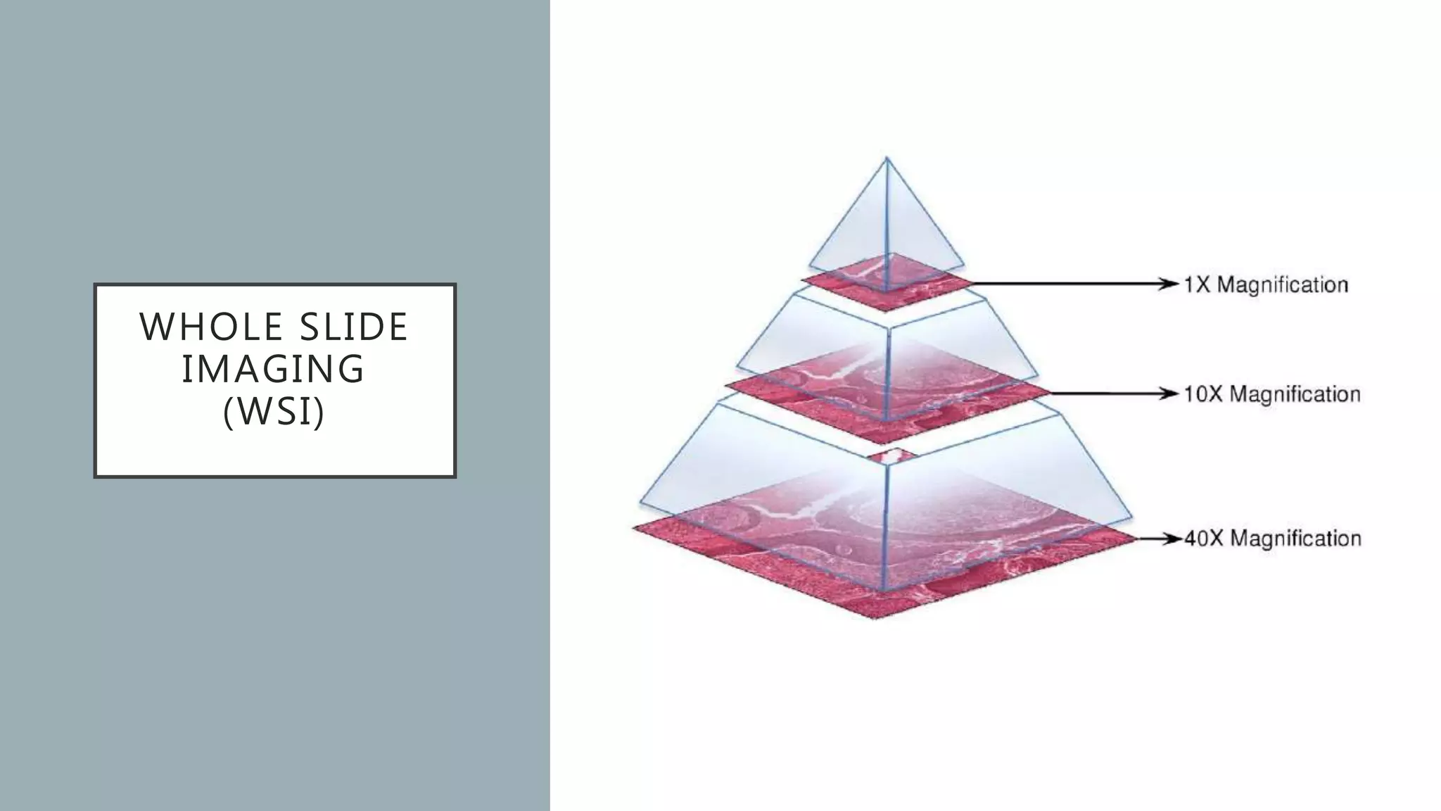 Promise of ai in improving cancer diagnosis and management | PPTX