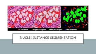 Promise of ai in improving cancer diagnosis and management | PPTX