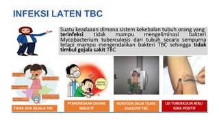 promkes rsud tbc anak.pdf