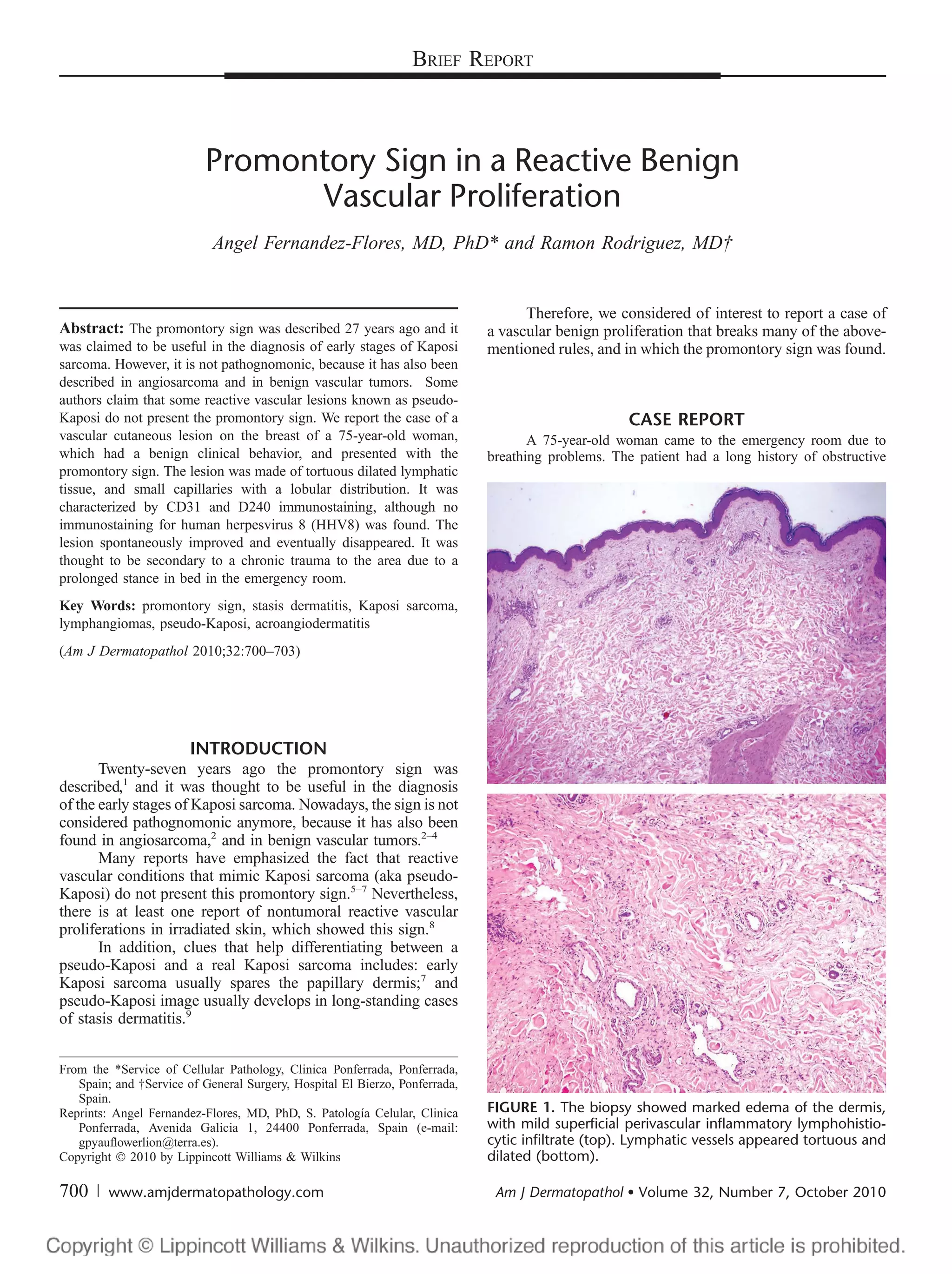 Promontory sign in a reactive benign vascular lesions | PPTX