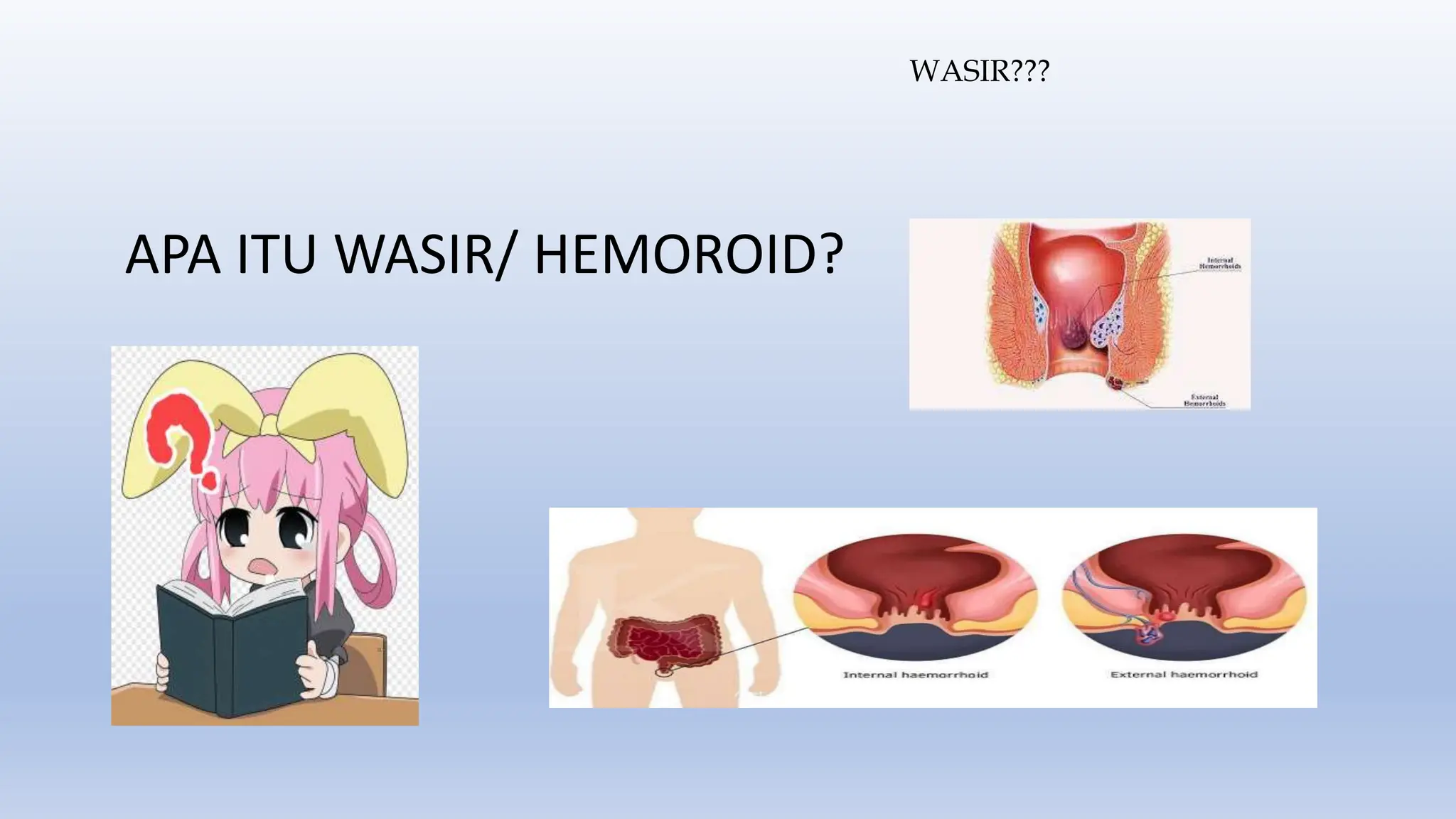 Promosi kesehatan wasir atau hemoroid.pptx