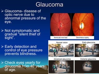 Promoting eye health for Elderly 1.ppt