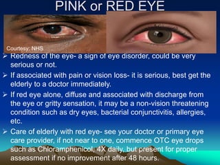 Promoting eye health for Elderly 1.ppt