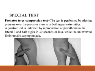 PRONATER TERES SYNDROM - Copy (2).pptx
