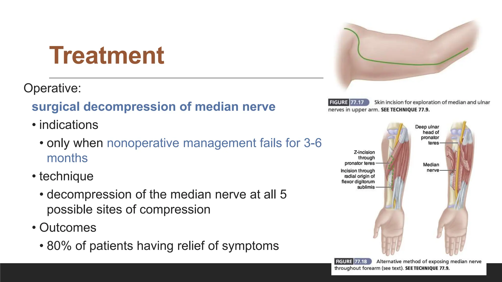 Pronator Teres Syndrome (Pronator Syndrome).pptx