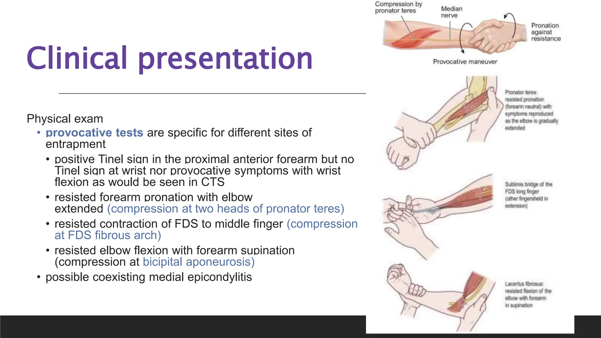 Pronator Teres Syndrome (Pronator Syndrome).pptx