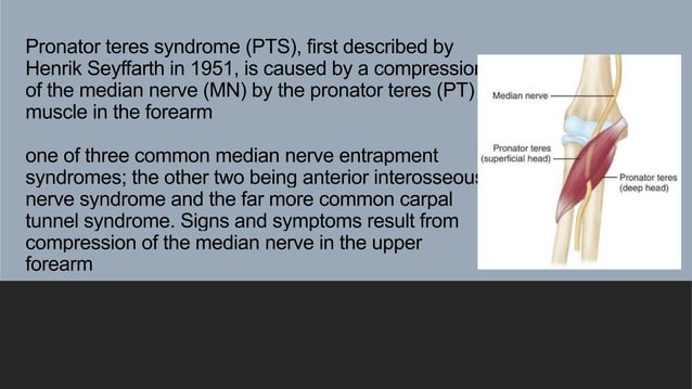 Pronator Teres Syndrome (Pronator Syndrome).pptx | Death, Injury, or ...