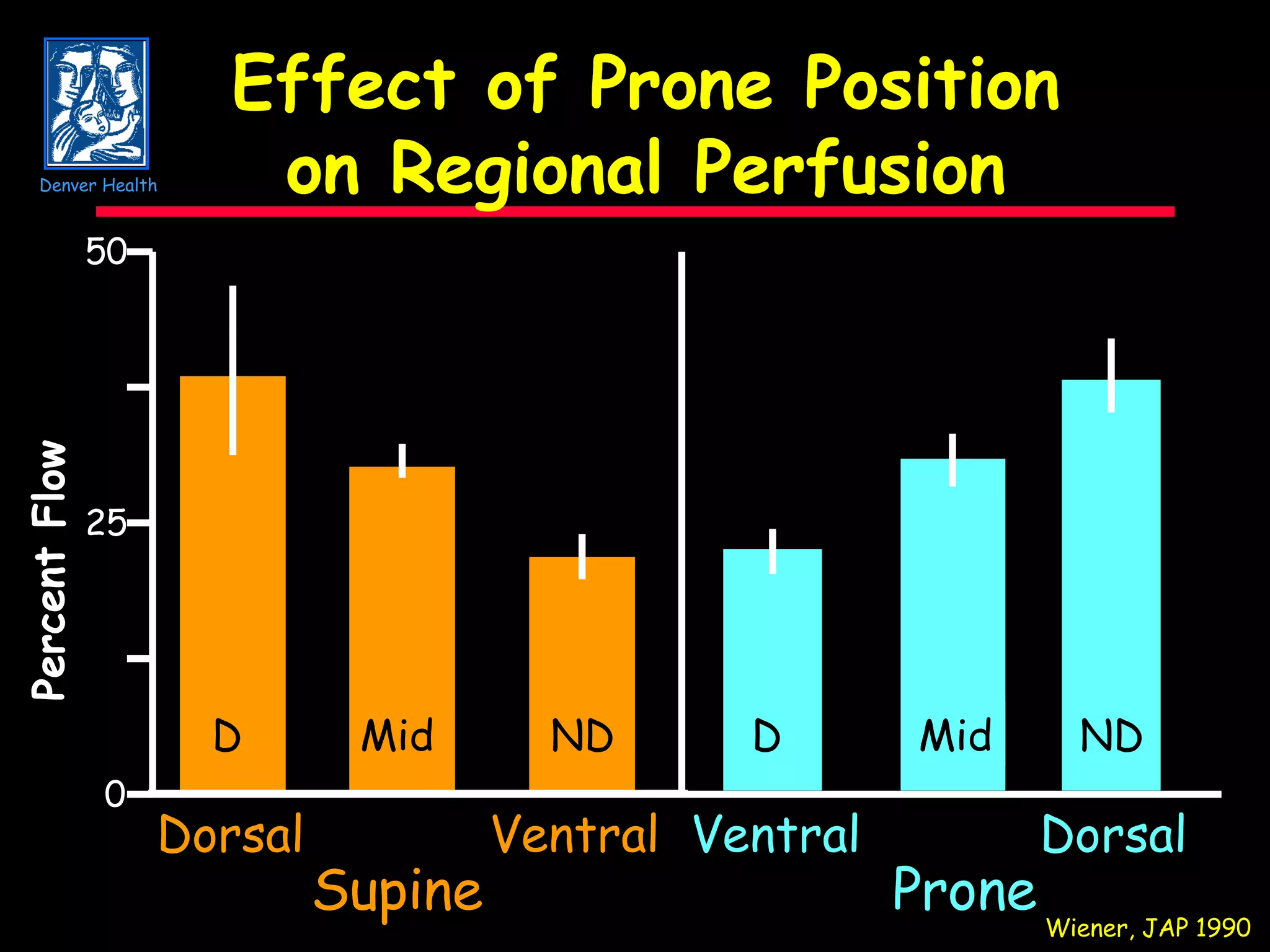 Prone Ventilation In ARDS | PPT