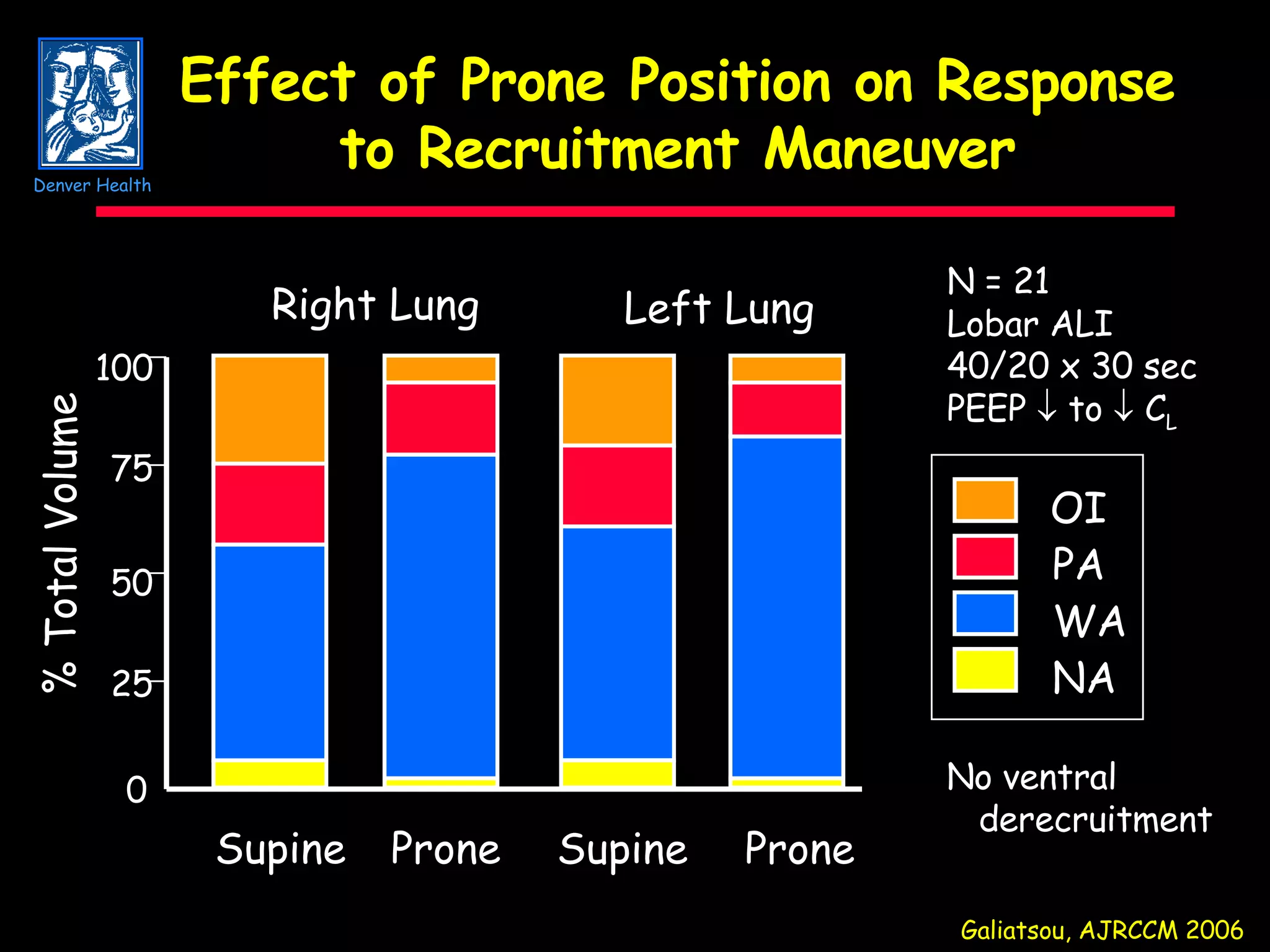 Prone Ventilation In ARDS | PPT